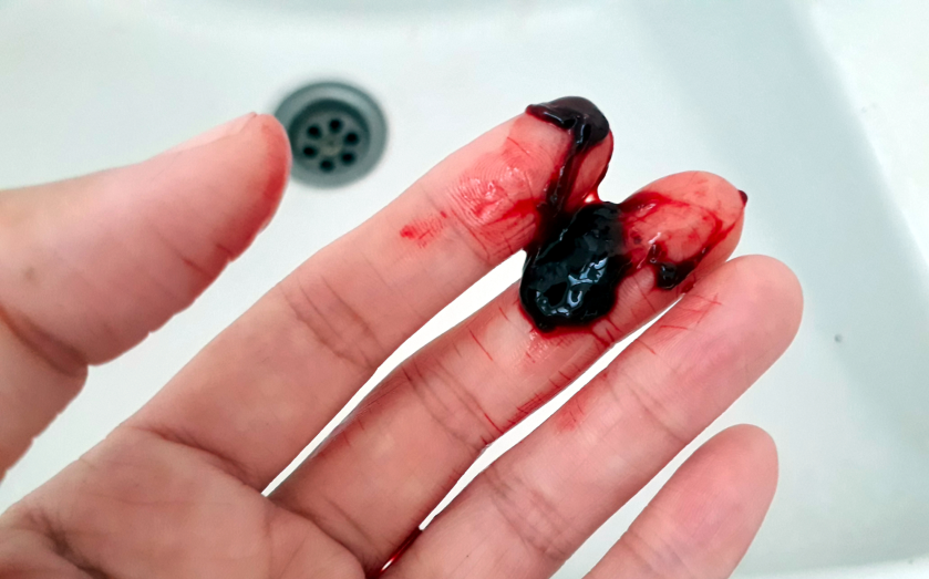 Period Blood Clots Causes How To Manage Them Modibodi UK period-blood-clots-causes-how-to-manage-them-modibodi-uk
